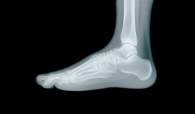 Aretto Kids - World's First Expanding Shoes For Growing Kids